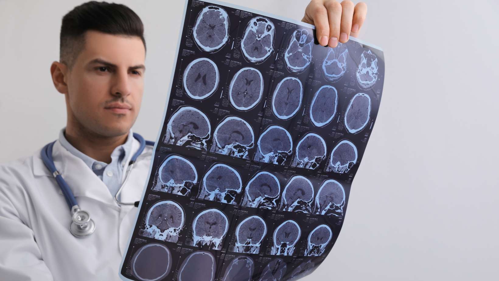 Understand difference between a Seizure and convulsion