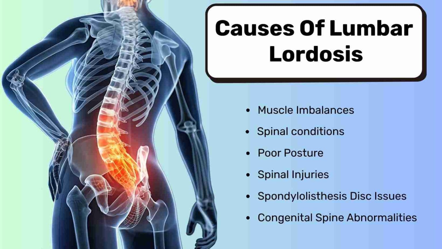 What Is Lumbar Lordosis? Causes, Symptoms & Treatment