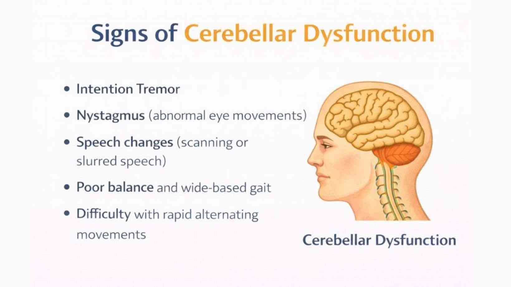 What Is Dysmetria? Causes, Symptoms & Diagnosis